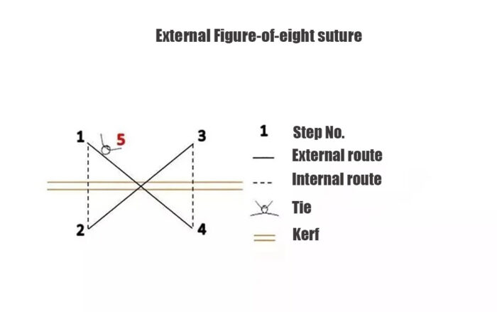 How to Tie Surgical Sutures? | Surgical-tool