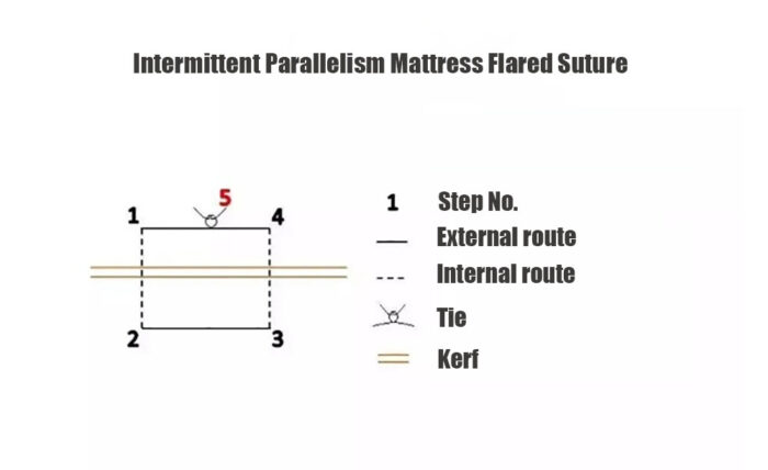 How to Tie Surgical Sutures? | Surgical-tool