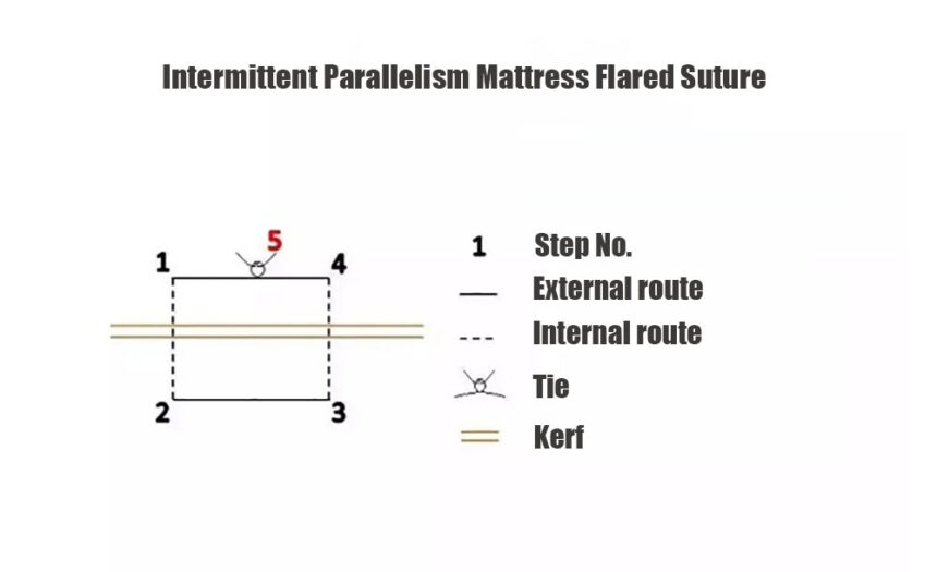How to Tie Surgical Sutures? | Surgical-tool