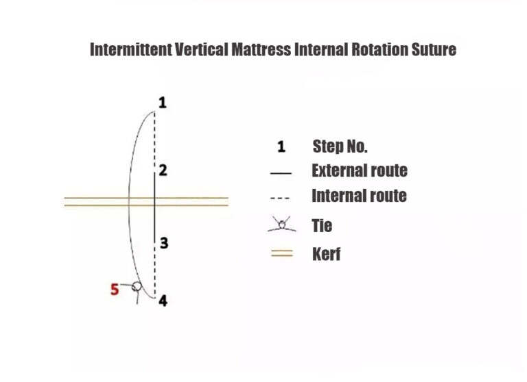 How to Tie Surgical Sutures? | Surgical-tool
