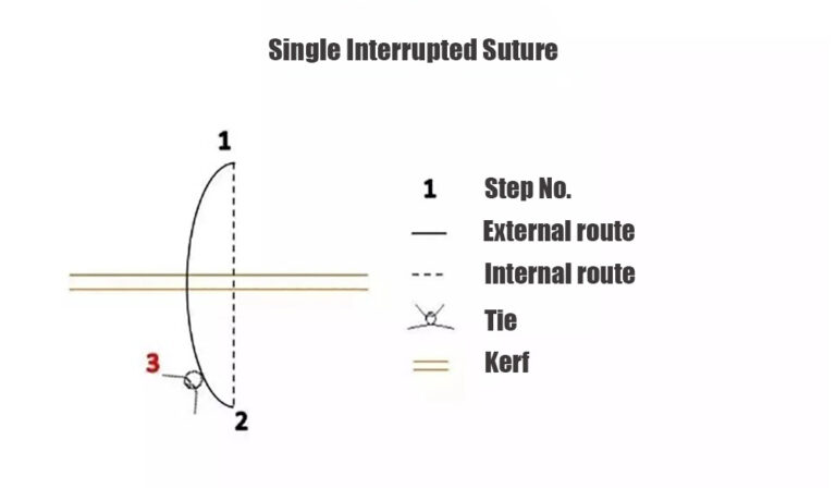 How to Tie Surgical Sutures? | Surgical-tool