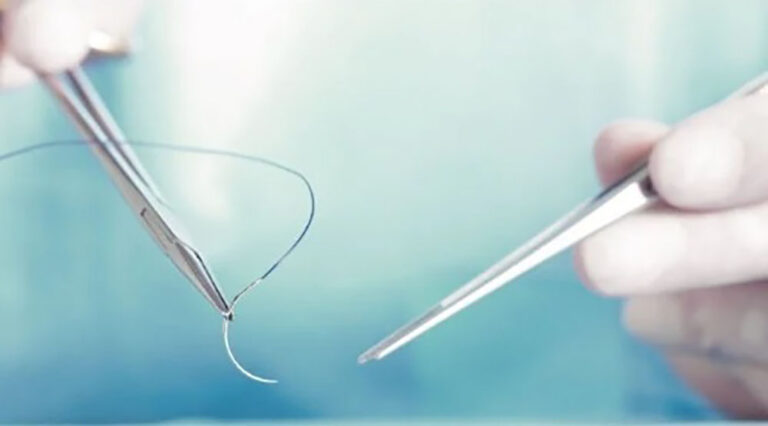 How to Tie Surgical Sutures? | Surgical-tool